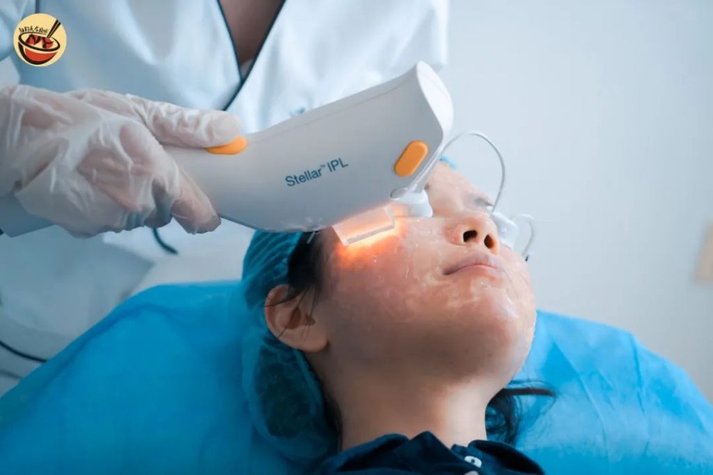 纽约法拉盛 | 雅婕 AOPT 光子嫩肤 | M22 王者之心 | 美容 | 祛斑 | 祛皱